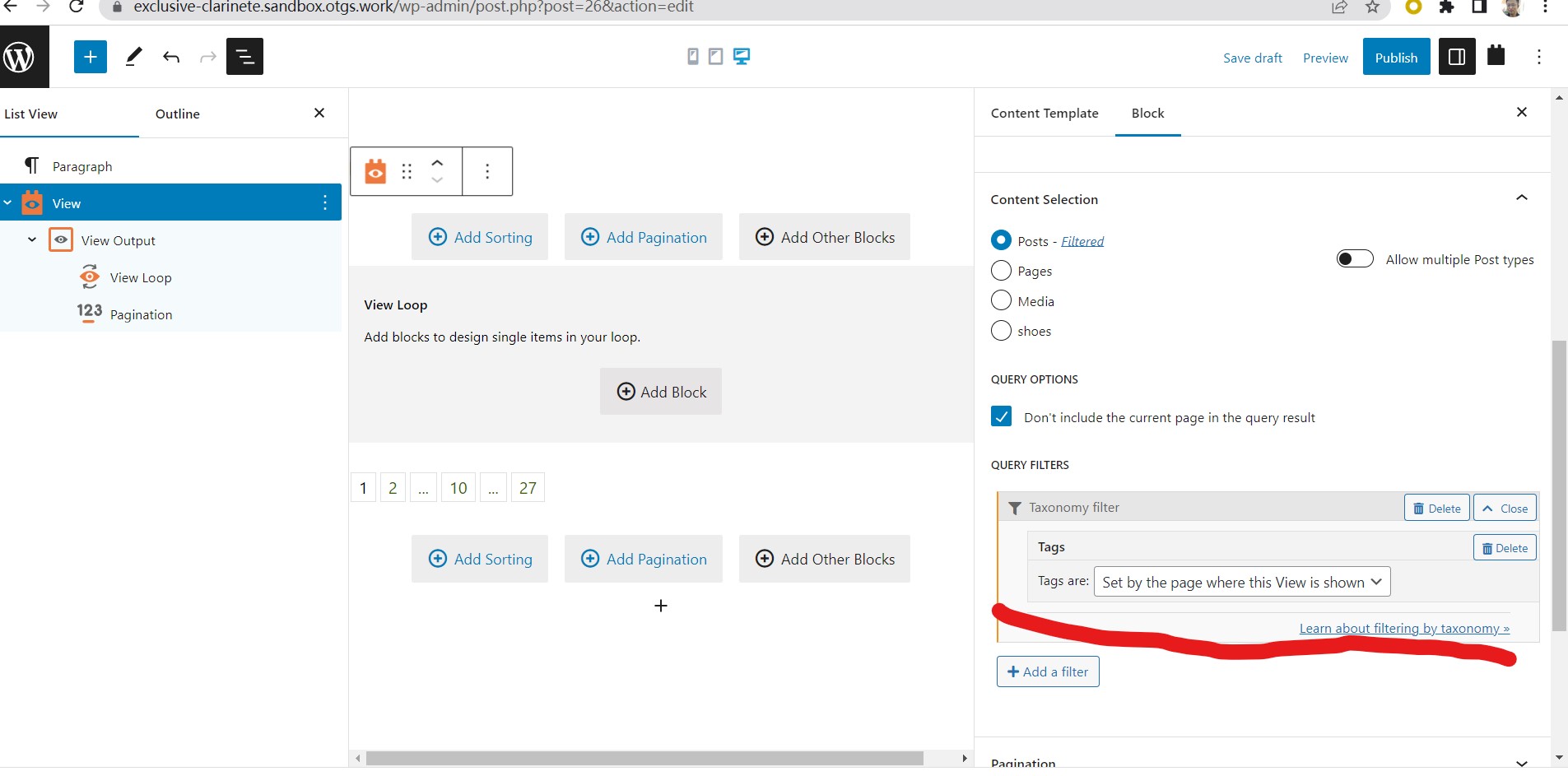 Display Normal Posts By Tag On A Custom Post Type Content Template